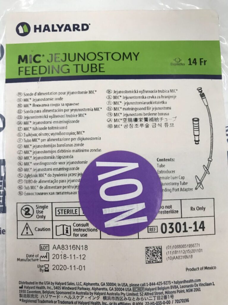 Feeding Catheter Jejunostomy at Kaitlyn Devine blog